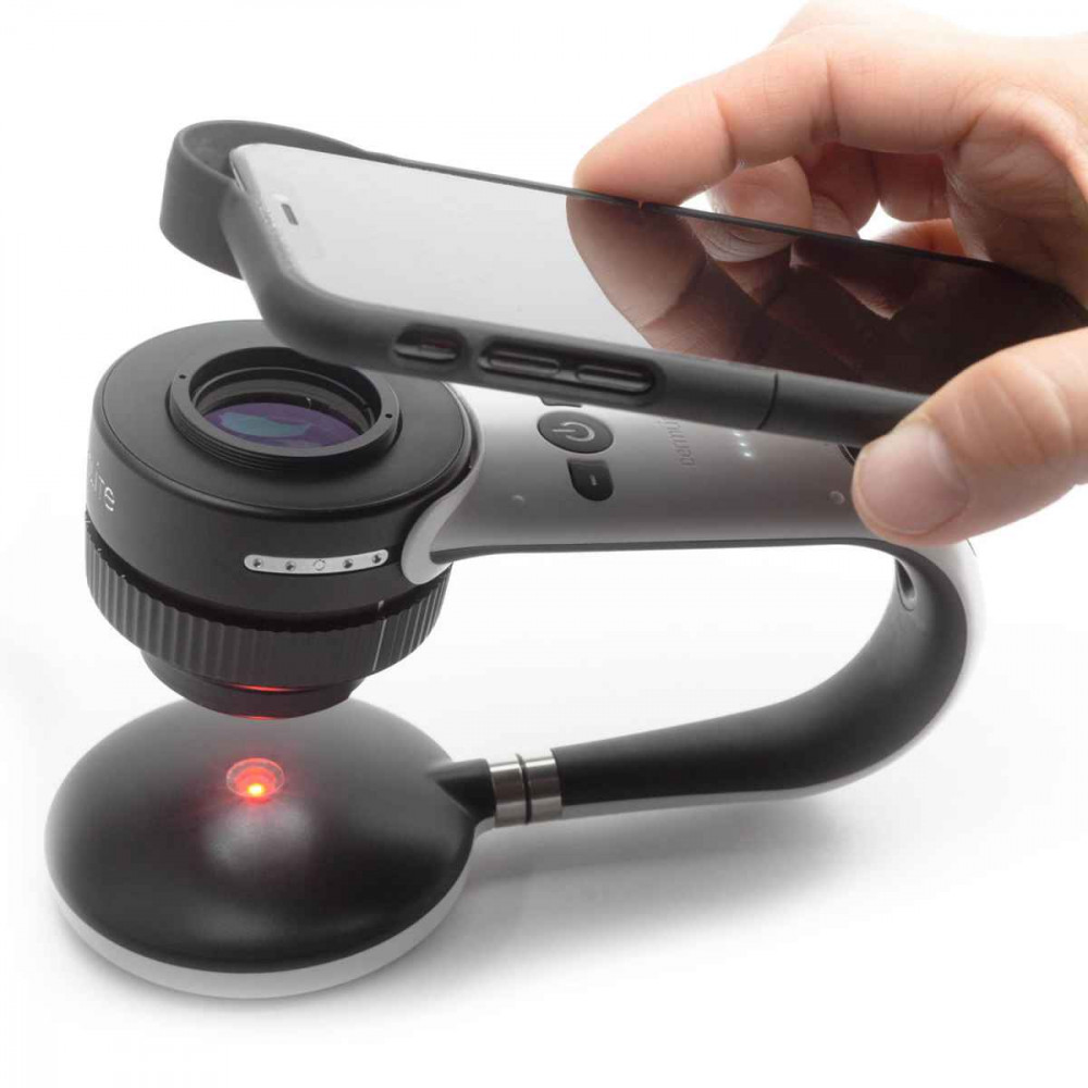 DermLite Foto X with Nailio - Winterthur Medical medical dev