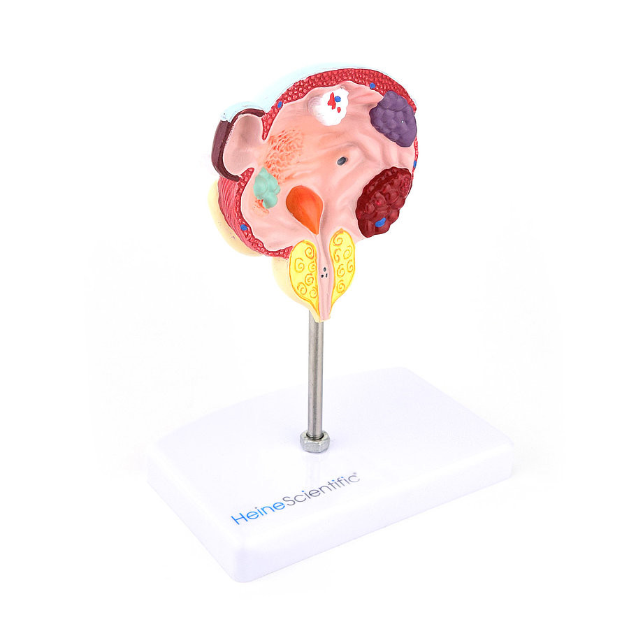 Bladder model with prostate - Winterthur Medical Plc. medica