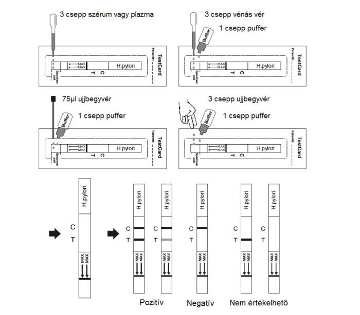 Helicobacter pylori antibody test strip, blood/serum/plasma,
