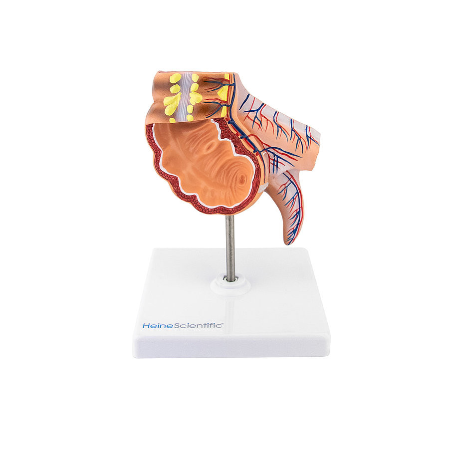 Appendix and caecum model - Winterthur Medical Plc. medical