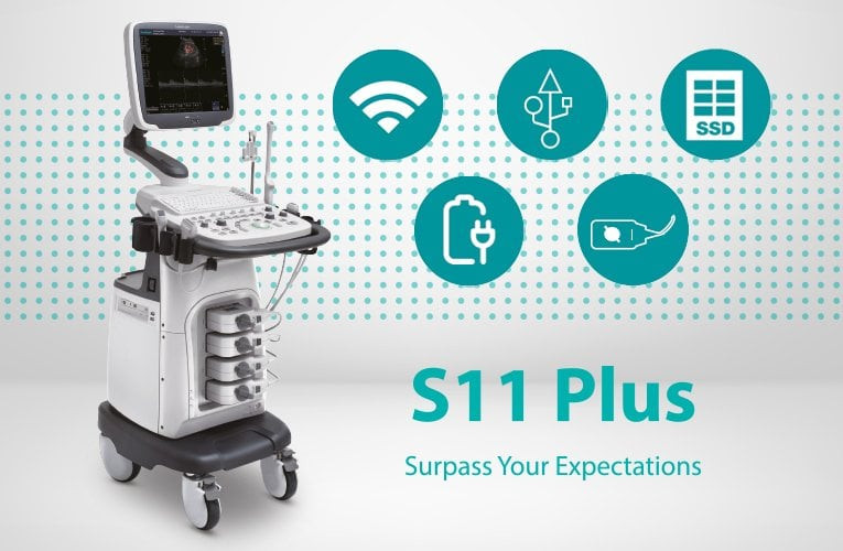 SonoScape S11 Plus ultrasound system - Winterthur Medical me