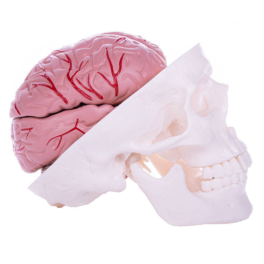 Skull-brain model - Winterthur Medical Plc. medical devices